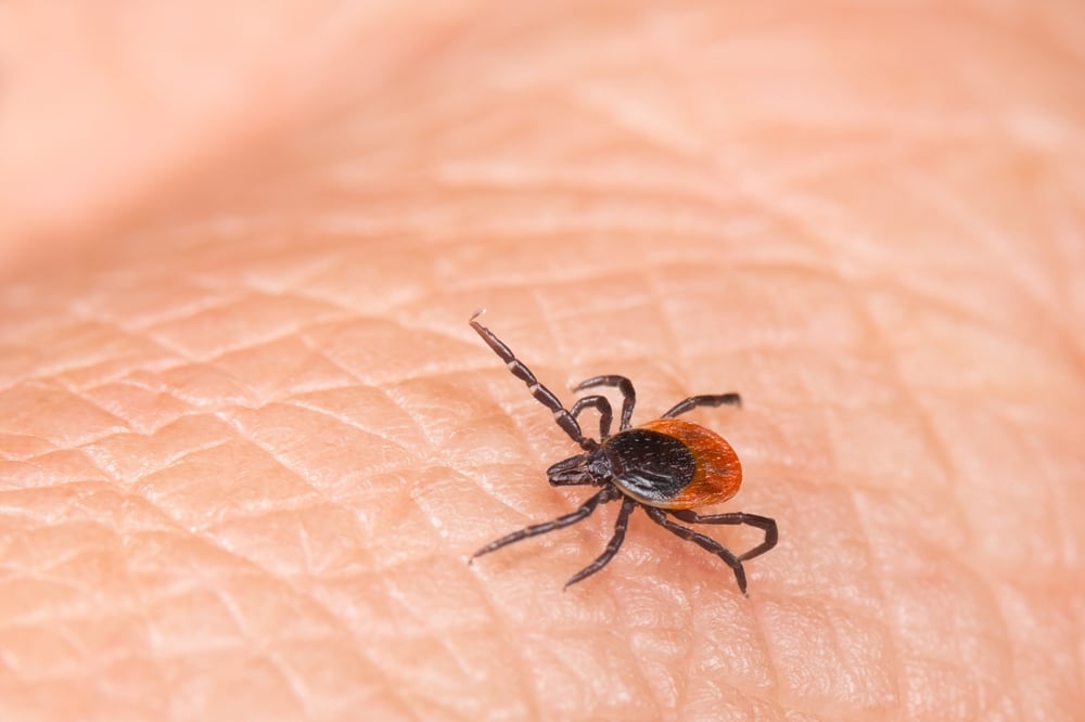 What you need to know about ticks this summer
